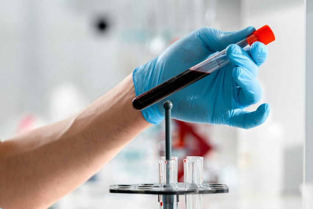 How Often Should Blood Tests Be Done? Guide